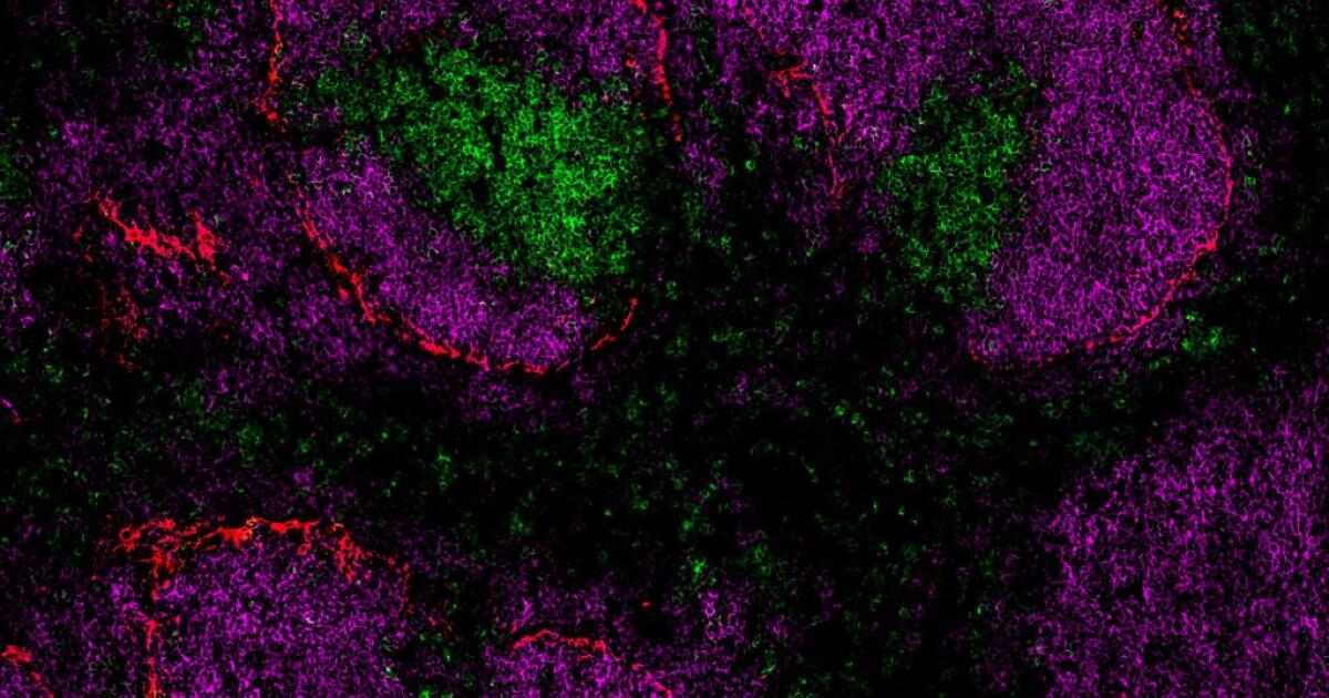 MediCity Research Laboratory | University of Turku